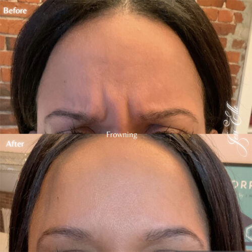 Gallery | Adorn Medical Aesthetics in North Andover, MA