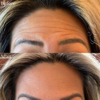 Gallery | Adorn Medical Aesthetics in North Andover, MA