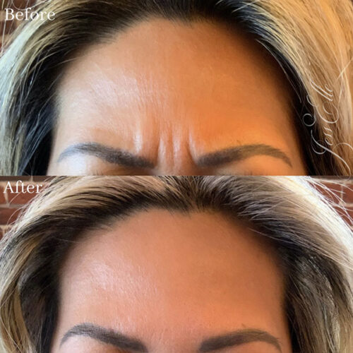 Gallery | Adorn Medical Aesthetics in North Andover, MA