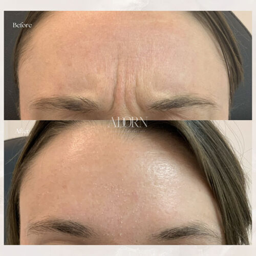 Gallery | Adorn Medical Aesthetics in North Andover, MA