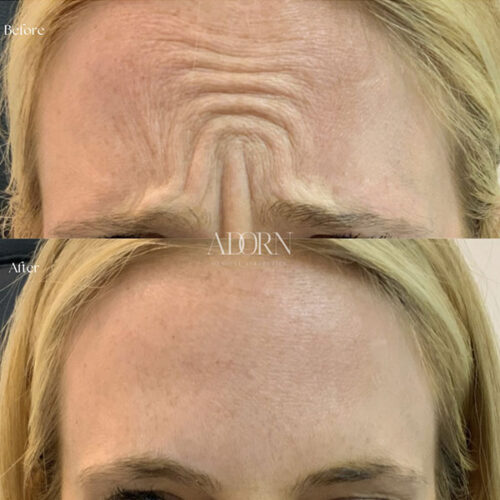 Gallery | Adorn Medical Aesthetics in North Andover, MA