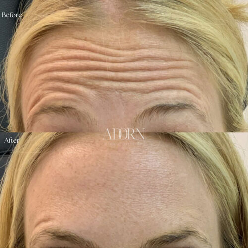Gallery | Adorn Medical Aesthetics in North Andover, MA