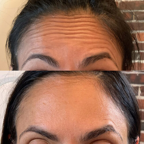 Gallery | Adorn Medical Aesthetics in North Andover, MA