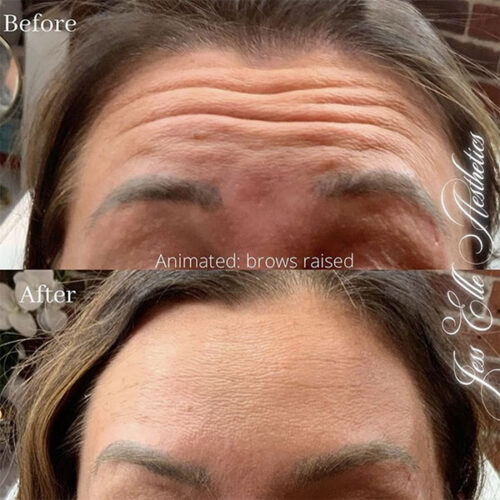 Gallery | Adorn Medical Aesthetics in North Andover, MA